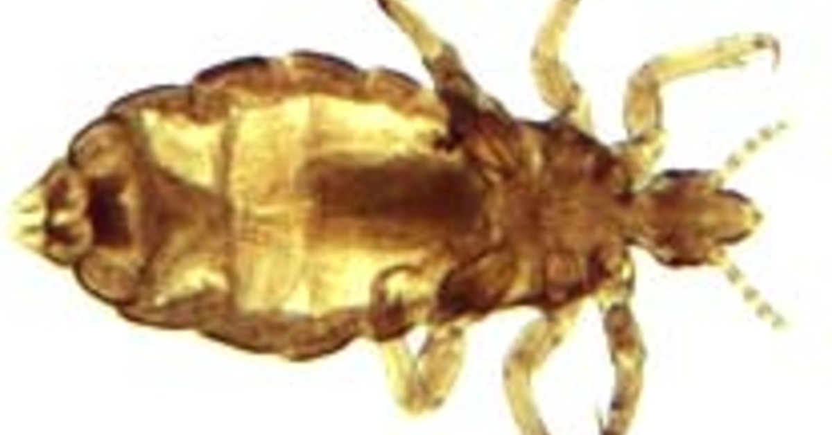 Comment se débarraser des poux et des lentes?