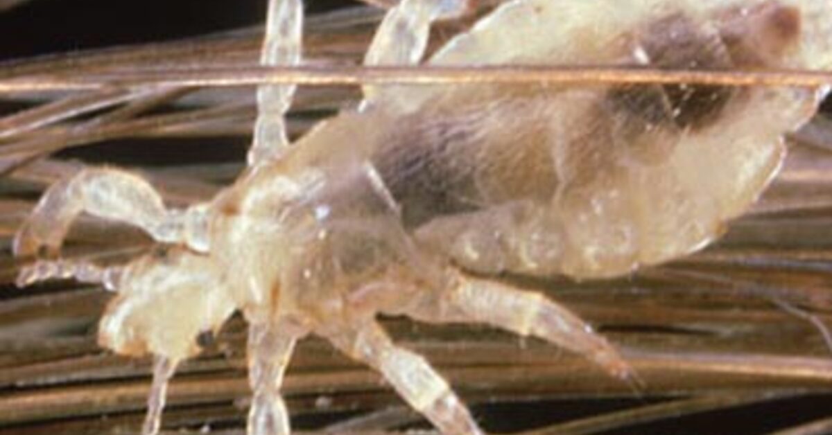 Traitement contre les poux : quoi faire